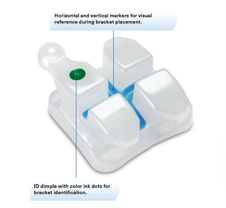 Treatment Options • Orthodontist Orland Park IL | Invisalign ...